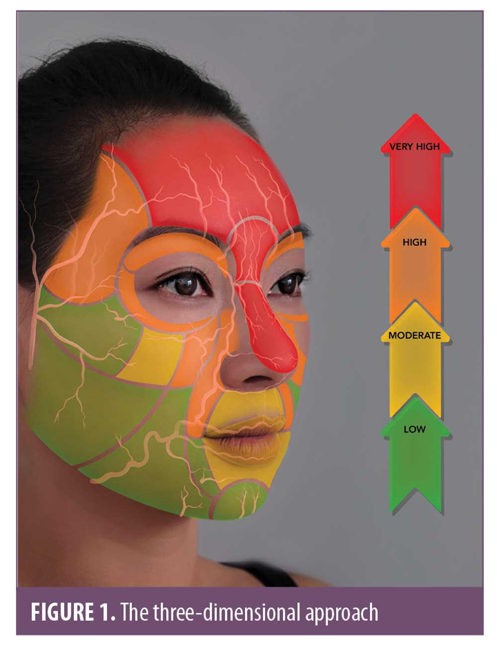 Vascular Occlusion After Dermal Fillers: Understanding, Prevention, And ...